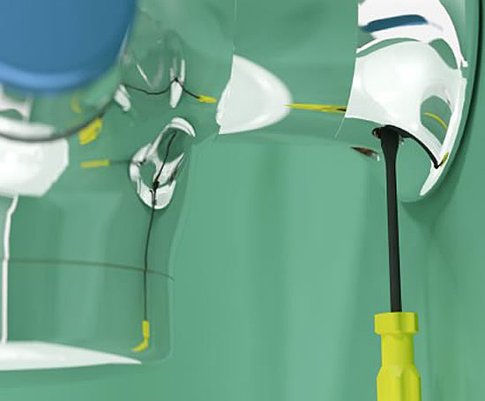 Optitherm thermostatic clinical tap | Horne Engineering | ESI Interior ...